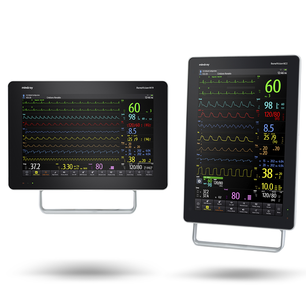 MINDRAY BeneVision N22/N19 — Toshkentda sotib oling